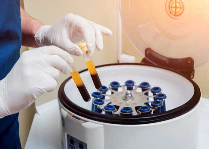 PRP Injections Shoulder | Cost of Platelet Rich Plasma Therapy | Boise ...